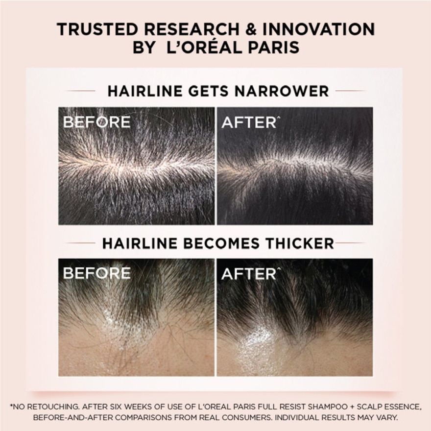 L'OREAL HAIR EXPERT, Full Resist Anti Hair Fall Shampoo 440ml & Scalp ...